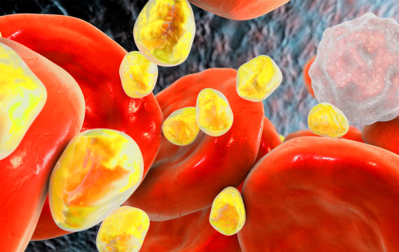 Global Heterozygous Familial Hypercholesterolemia Management Industry ...