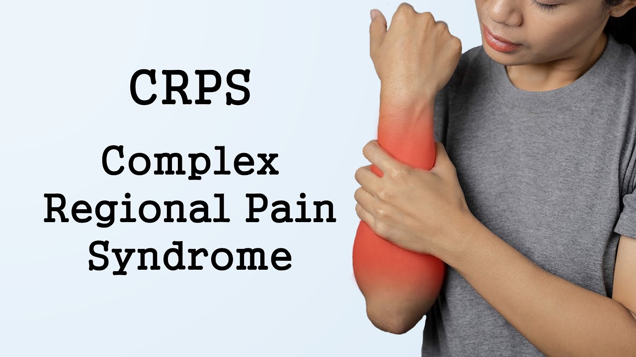 Global Complex Regional Pain Syndrome (CRPS) Market Set to Grow to USD 129.2 Million by 2033 at ...
