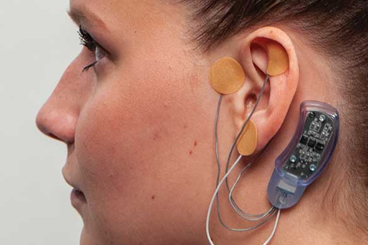 Global Neurostimulation Market Projected to Reach USD 15,417.4 million ...